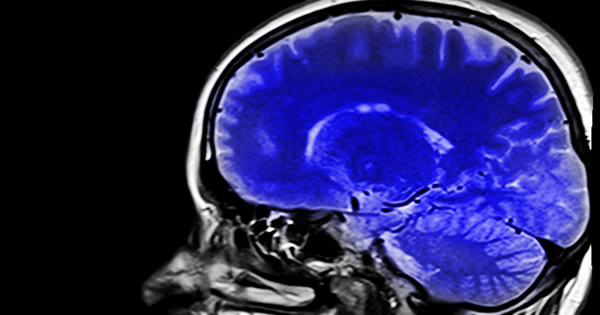 Trans brains more like gender they ID with: study